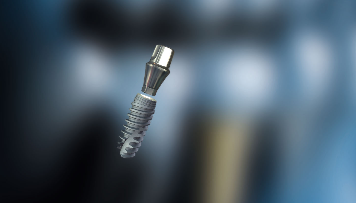 Formation Paro Implant en bref - Smile Concept Formation